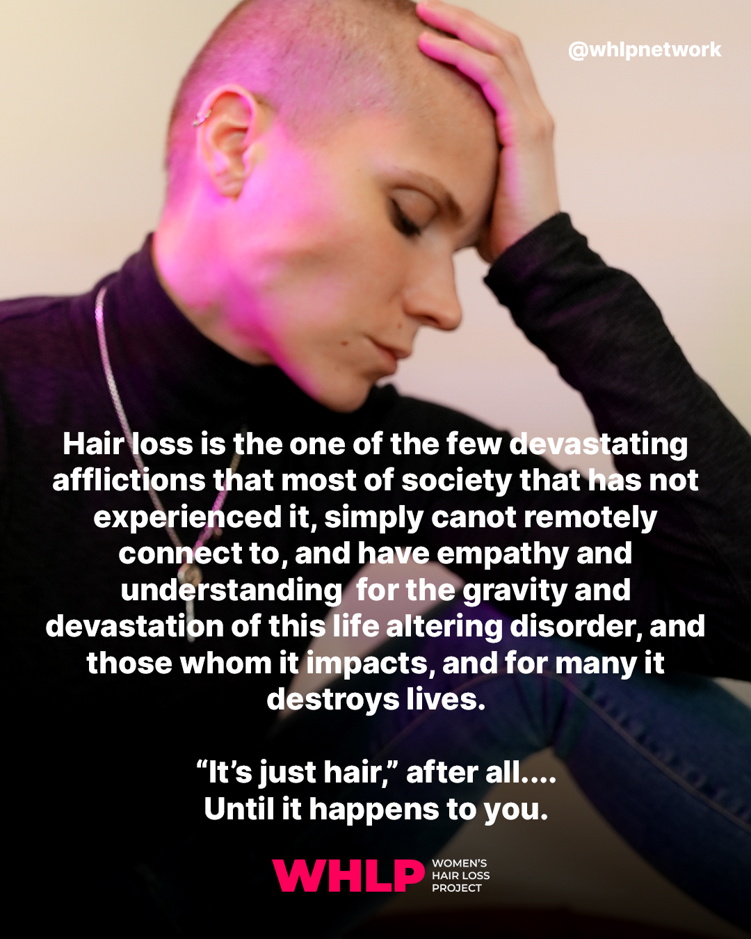 Women’s Hair Loss Project | Help, Hope and Understanding